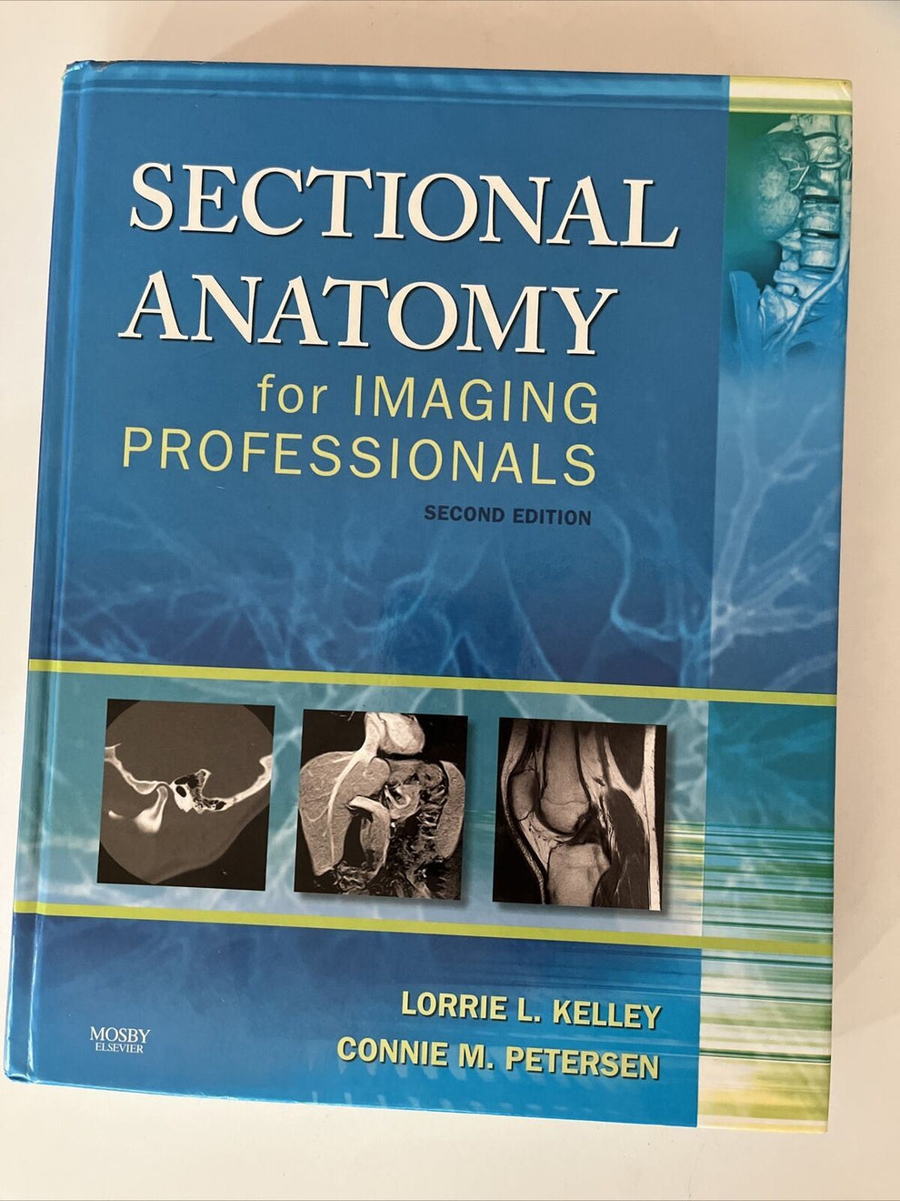 Sectional Anatomy for Imaging Professionals by Connie Petersen Second ...